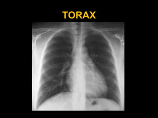Torax | PPT