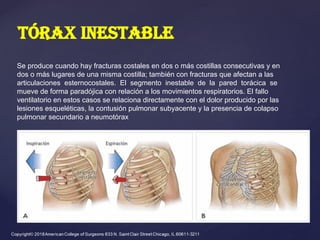 Traumatismo torácico 2025 con atls...... | PPTX