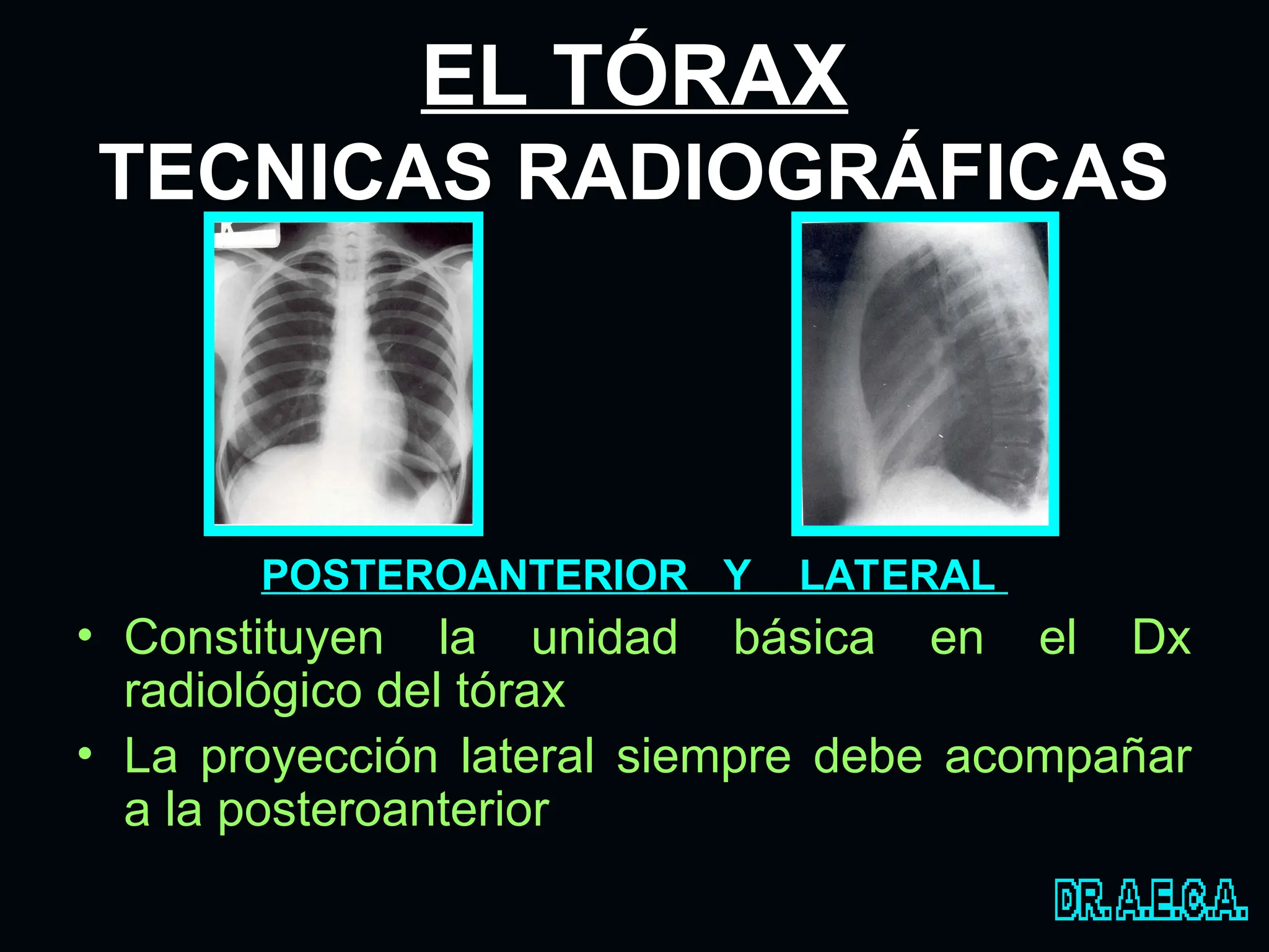 Imagenologia de torax, interpretacion de imagenes | PPT