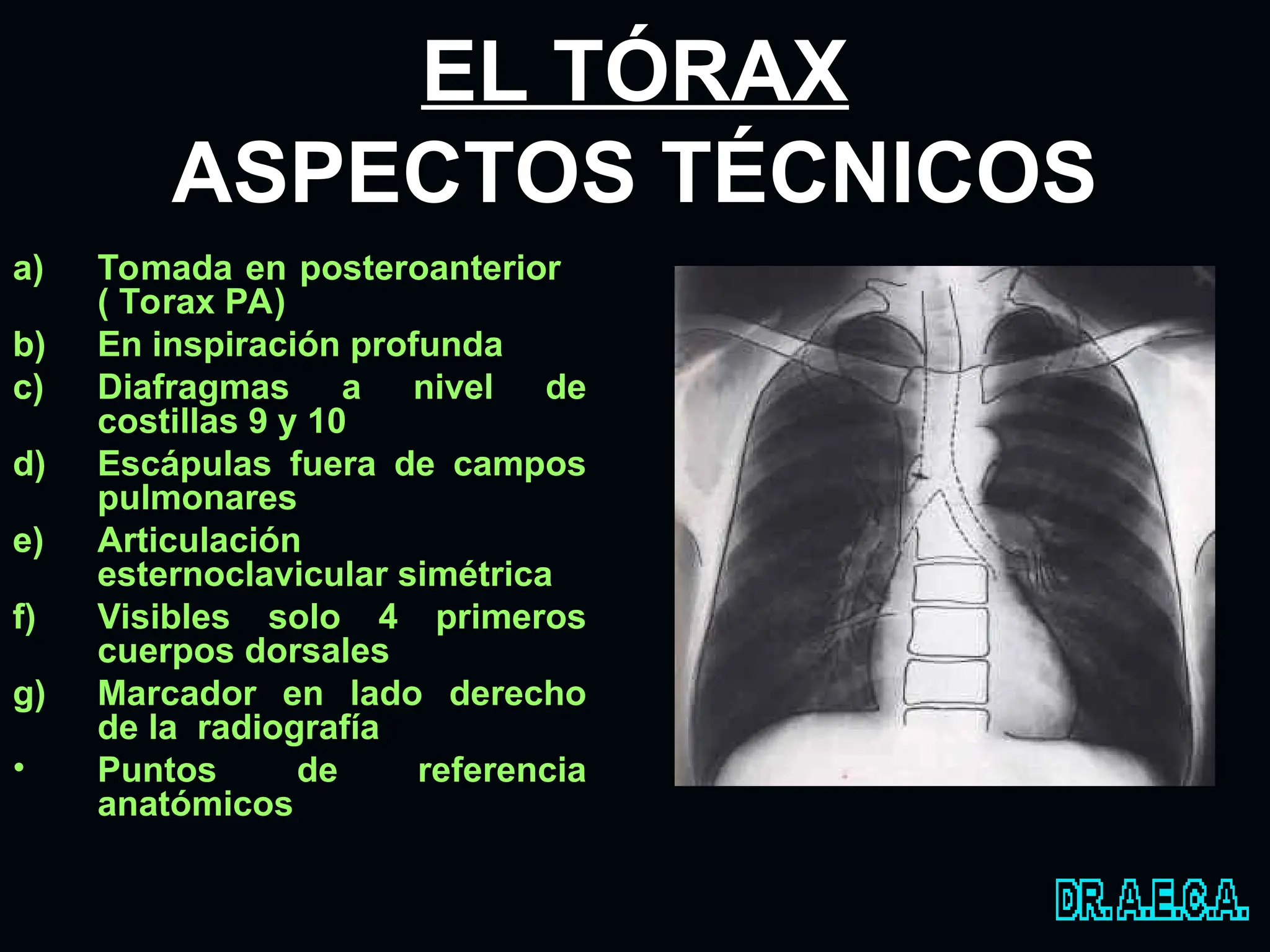 Imagenologia de torax, interpretacion de imagenes | PPT