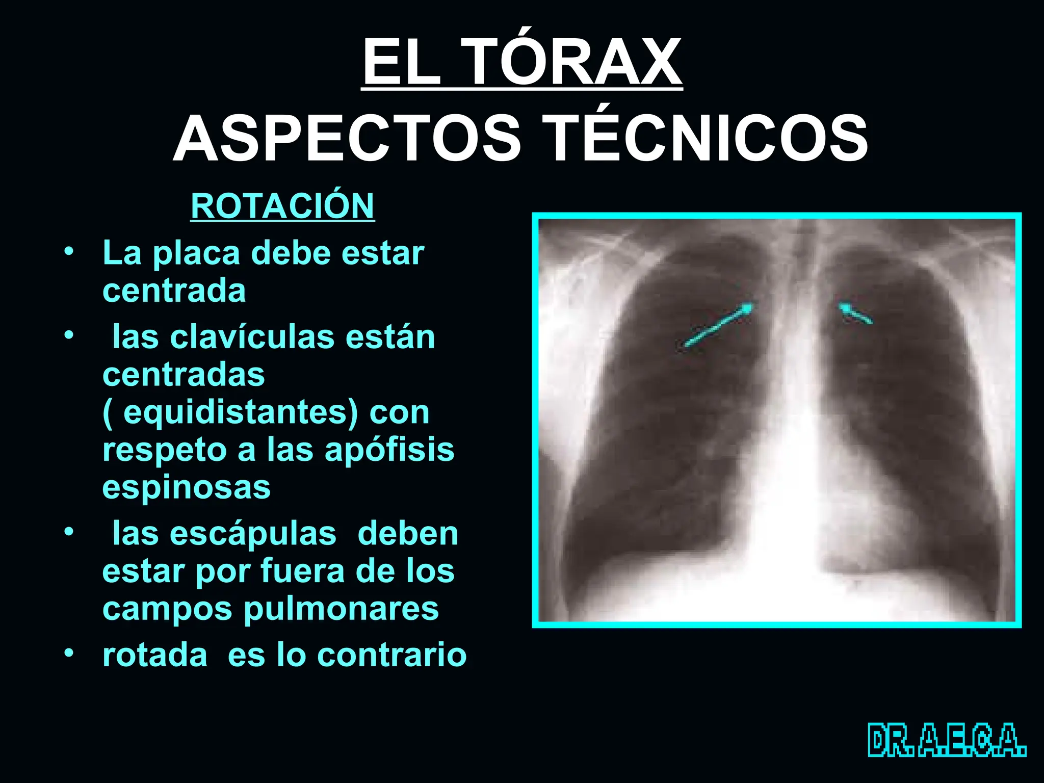 Imagenologia de torax, interpretacion de imagenes | PPT