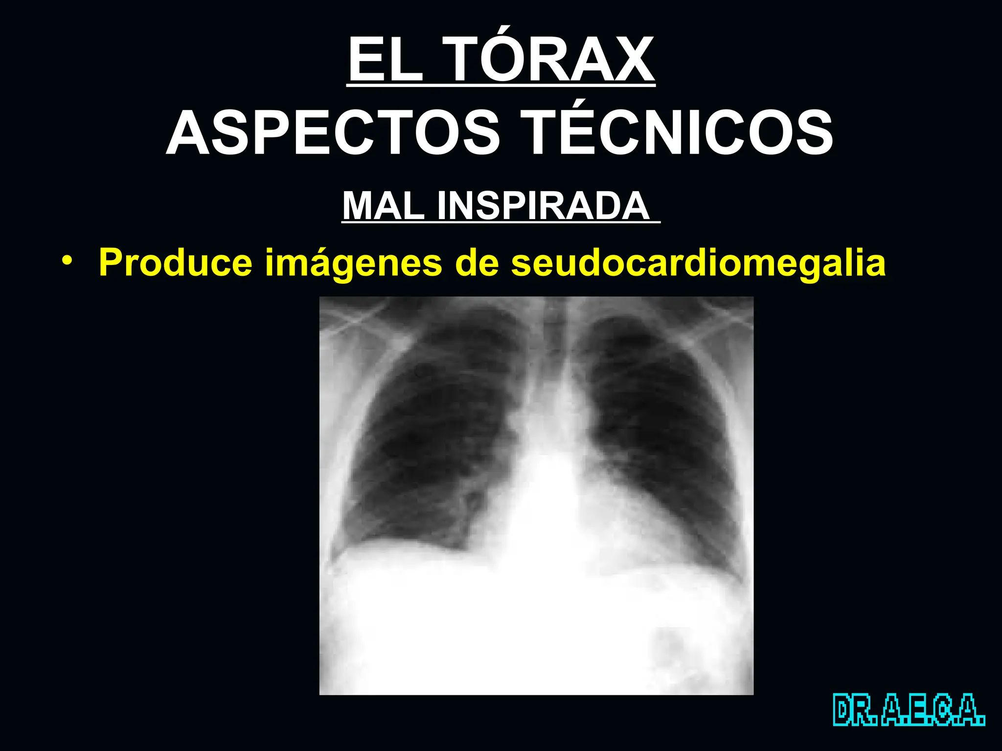 Imagenologia de torax, interpretacion de imagenes | PPT