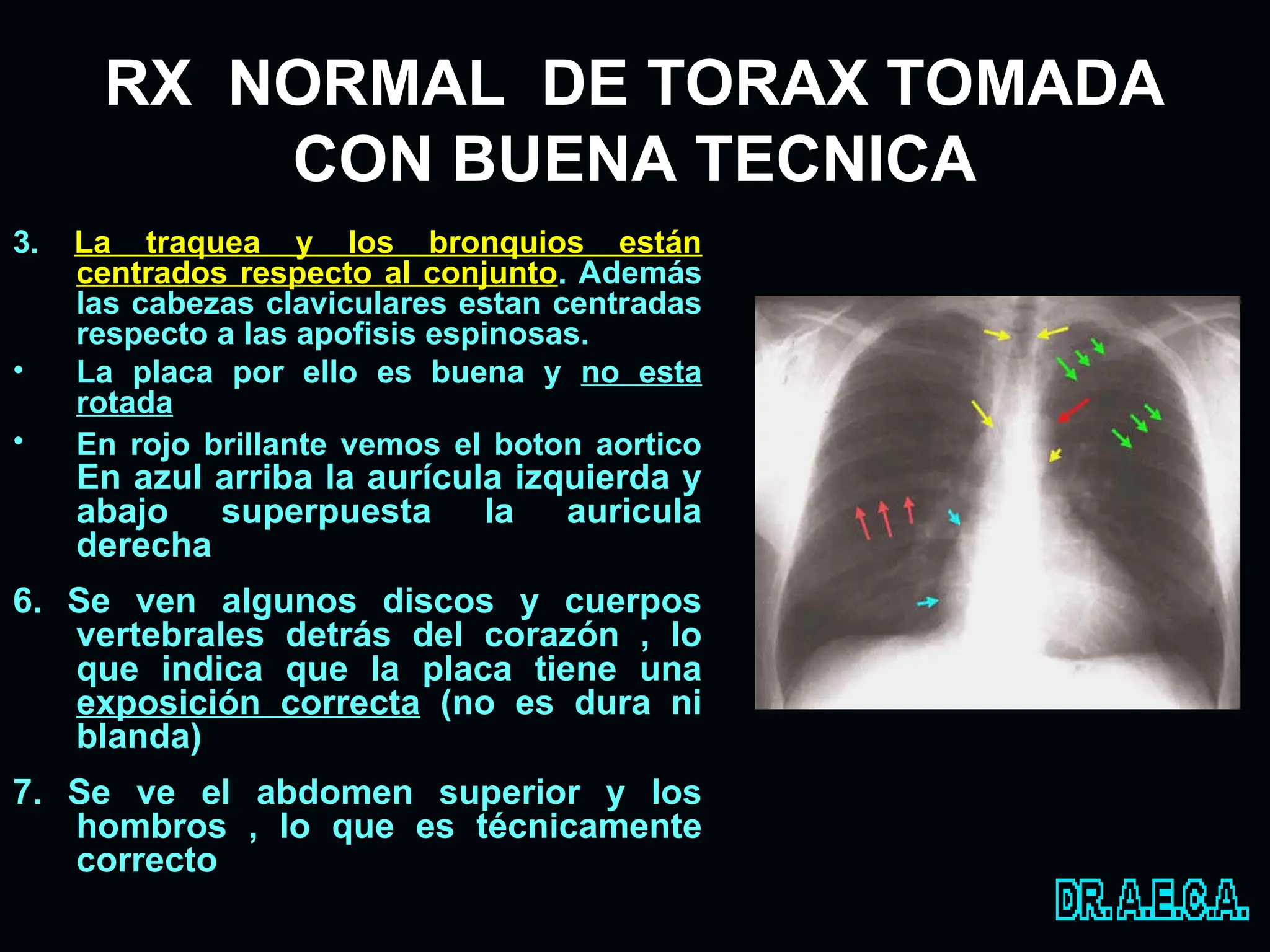Imagenologia de torax, interpretacion de imagenes | PPT