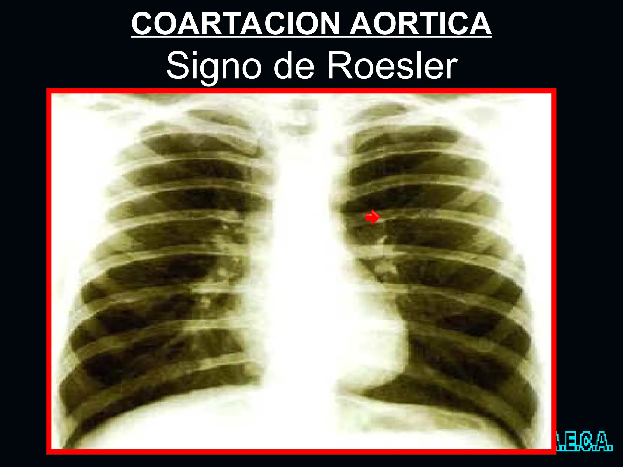Imagenologia de torax, interpretacion de imagenes | PPT