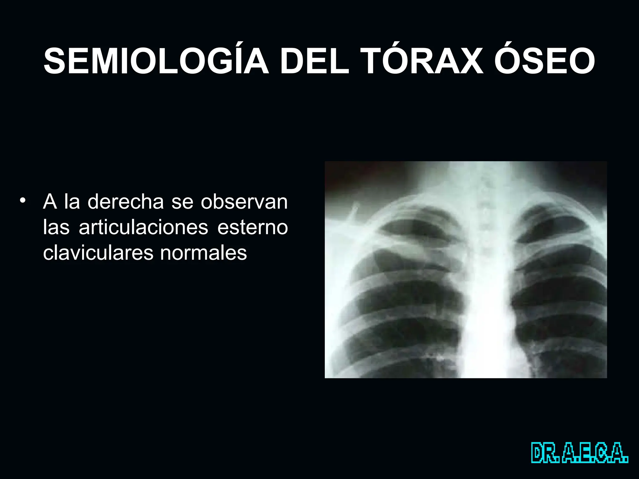Imagenologia de torax, interpretacion de imagenes | PPT