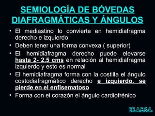 Imagenologia de torax, interpretacion de imagenes | PPT