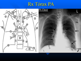 Radiología del Tórax 1-Medicina en imagen.ppt