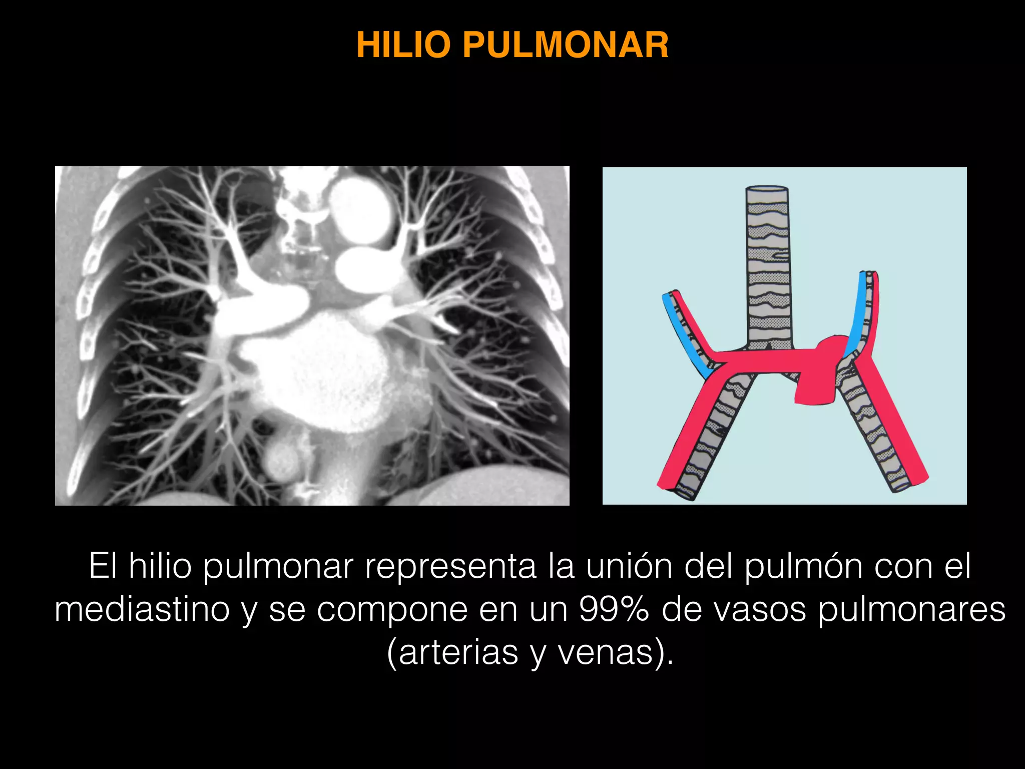 TORAX 2 PARTE (SILUETA CARDIACA E HILIOS) | PDF