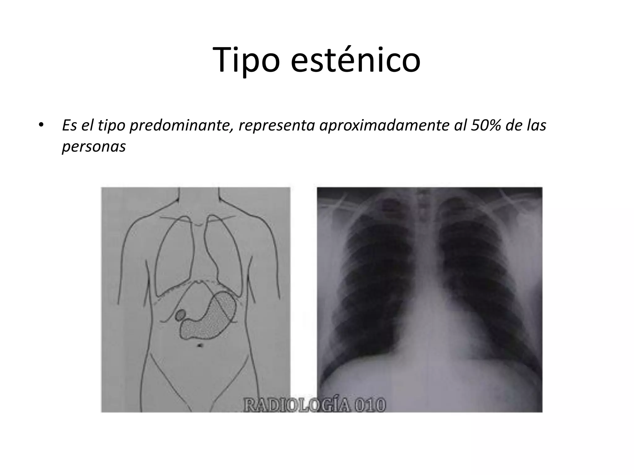 Tórax, esternón, costillas by Sócrates Pozo | PPT