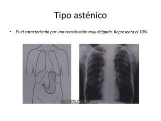 Tórax, esternón, costillas by Sócrates Pozo | PDF