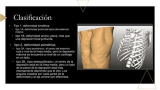 TORAX EXCAVATUM y carinatum.pptx | Surgery | Medical Health