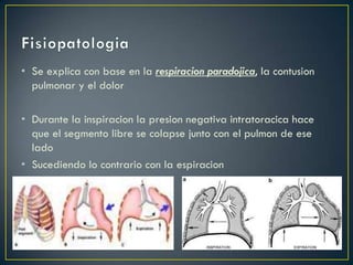 Torax inestable | PPTX