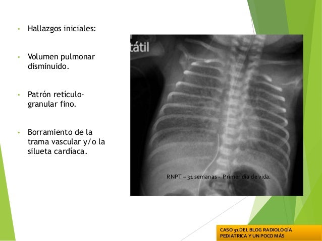Torax en Neonatologia