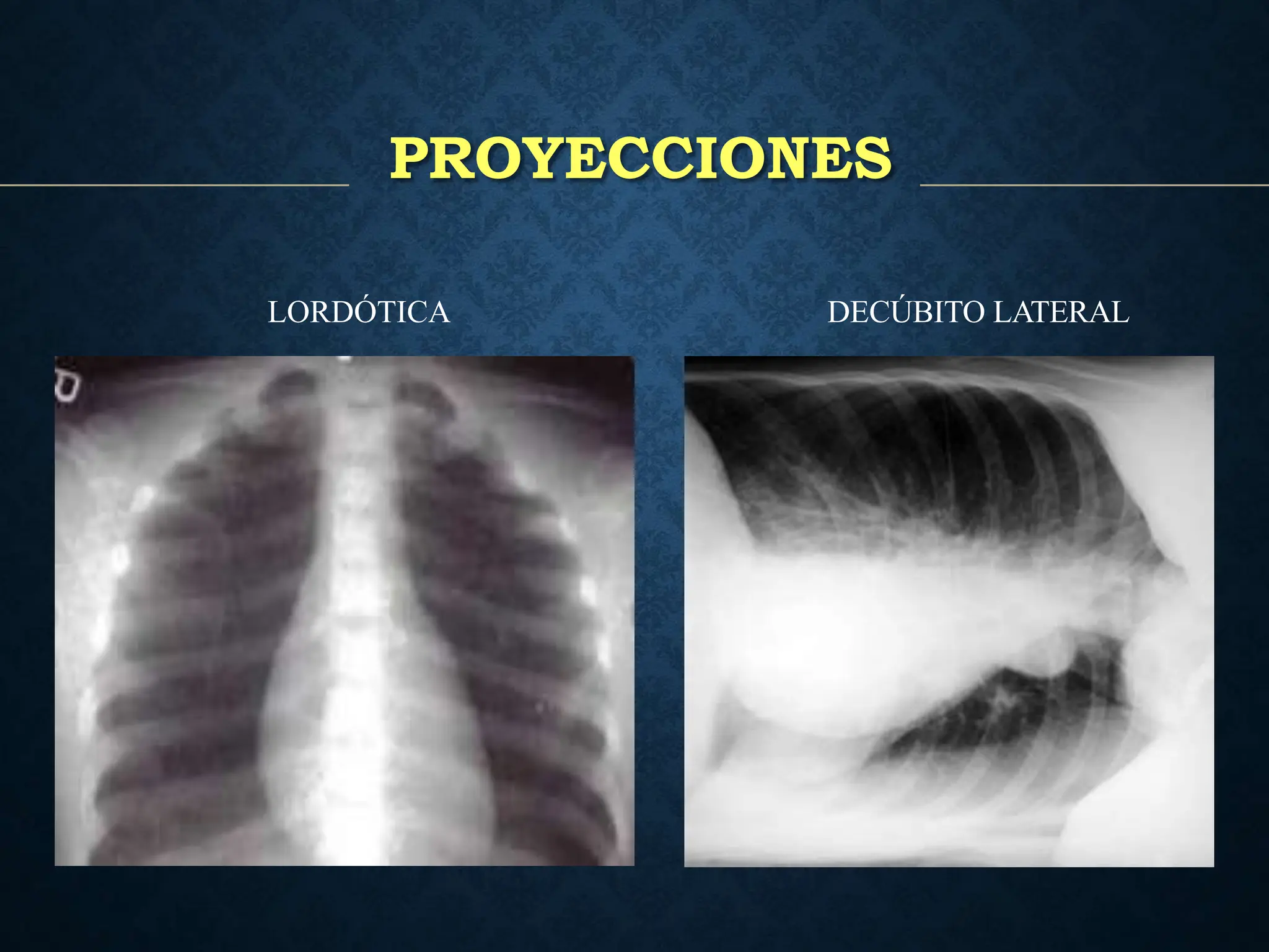 Torax normal-Oscar 2024- principios físicos del rx de torax | PPTX