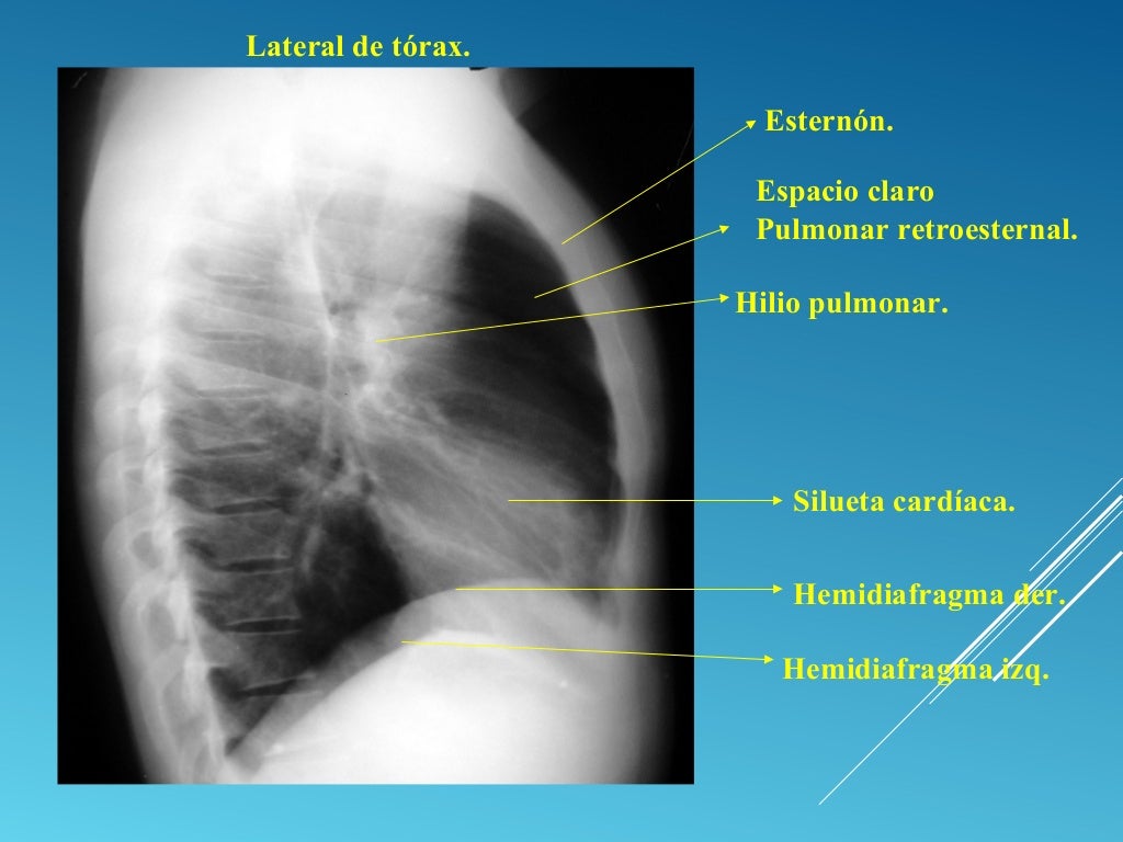 Torax normal en Imagenología