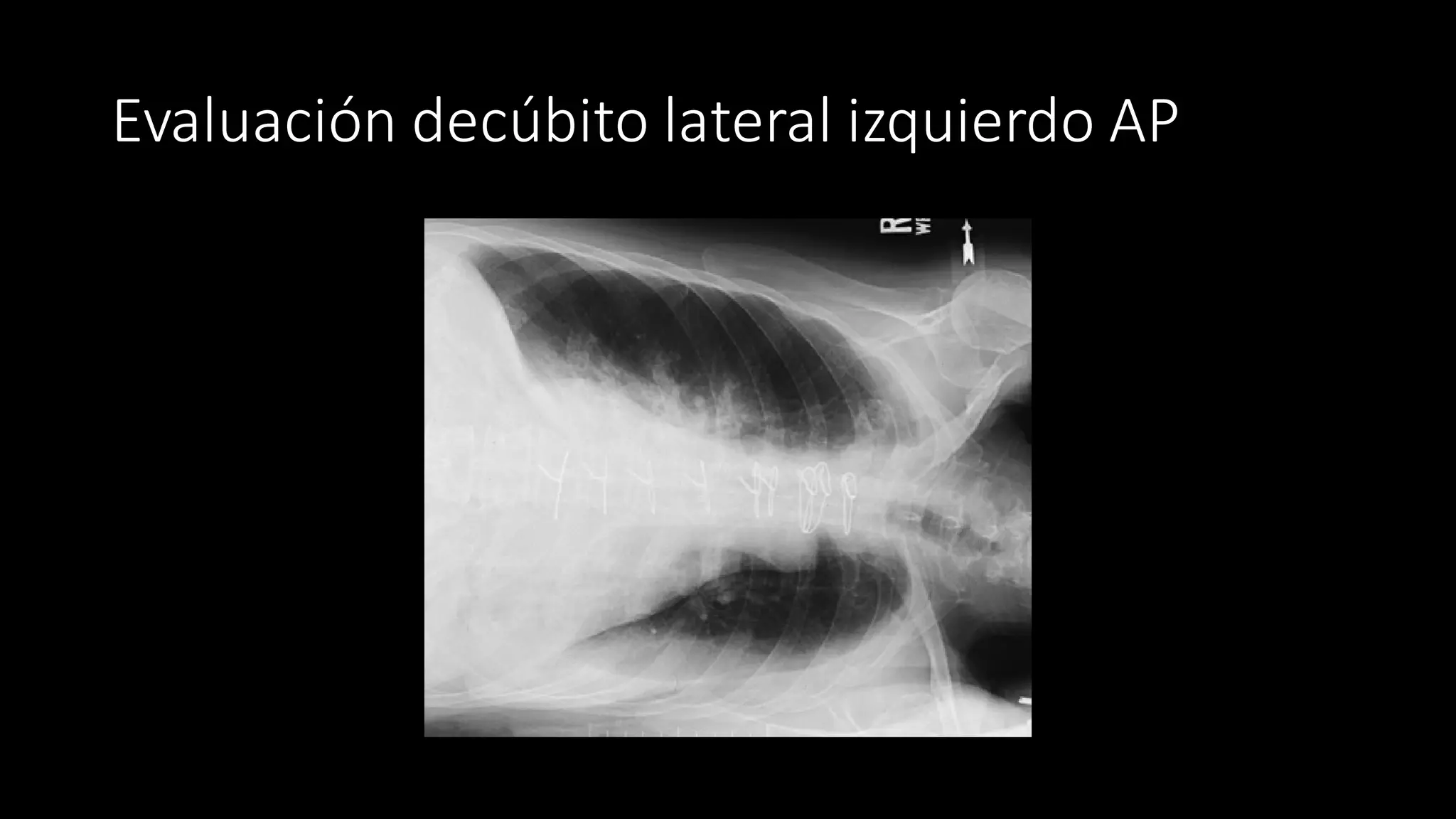 RAYOS X DE TORAX (INTRODUCCIÓN) FÍSICA Y POSICIONES | PDF