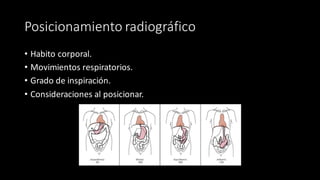 RAYOS X DE TORAX (INTRODUCCIÓN) FÍSICA Y POSICIONES | PDF