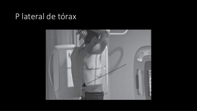 RAYOS X DE TORAX (INTRODUCCIÓN) FÍSICA Y POSICIONES