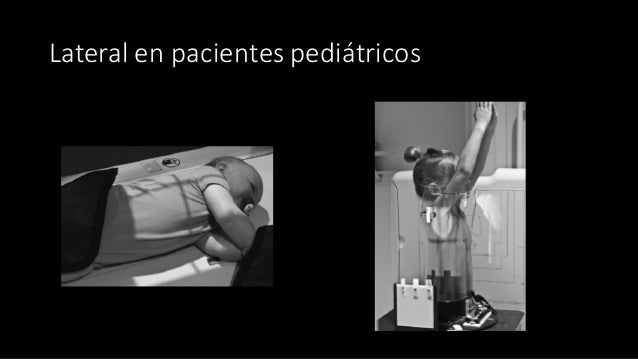 RAYOS X DE TORAX (INTRODUCCIÓN) FÍSICA Y POSICIONES