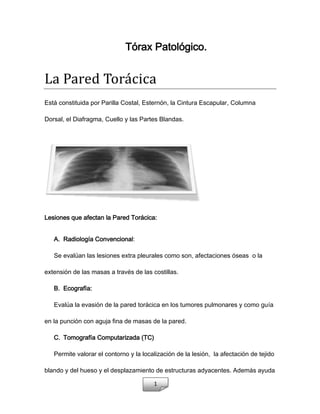 Torax patologico | DOCX
