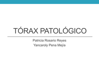 Tórax patológico | PPTX