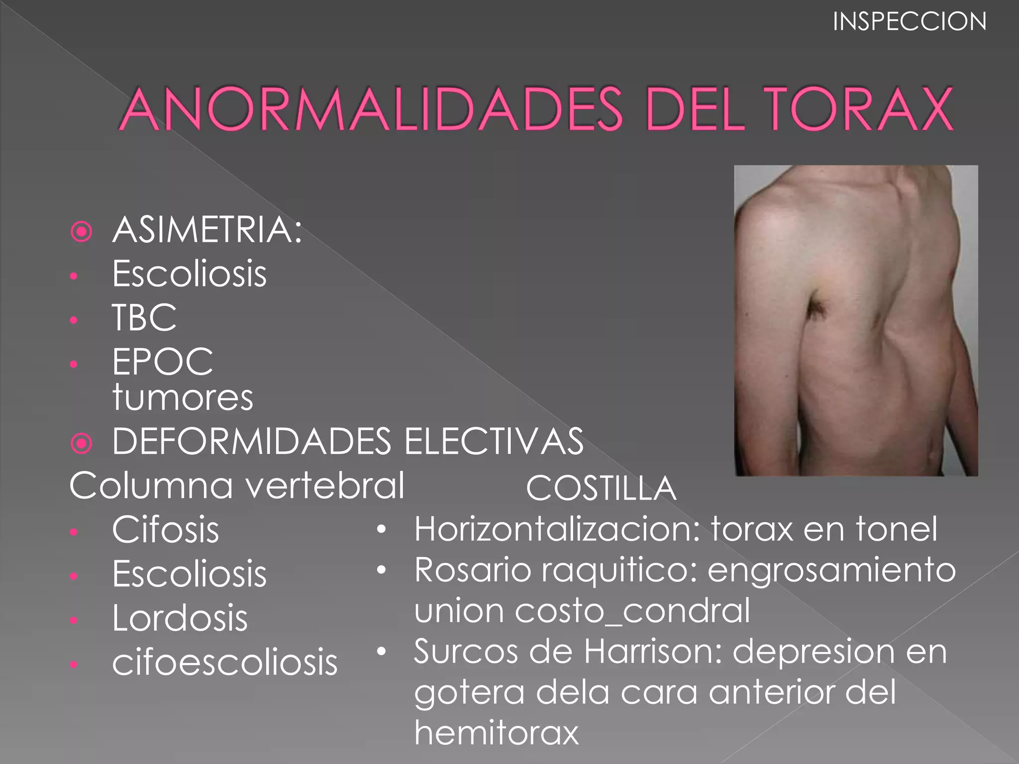 SEMIOLOGIA DE TORAX Y PULMONES
