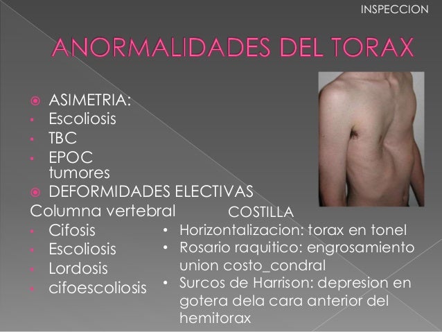 SEMIOLOGIA DE TORAX Y PULMONES