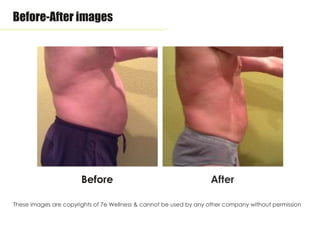 Torc body presentation | PDF