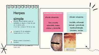 TORCH presentacion pediatria SINDROMES MAS COMUNES | PPTX