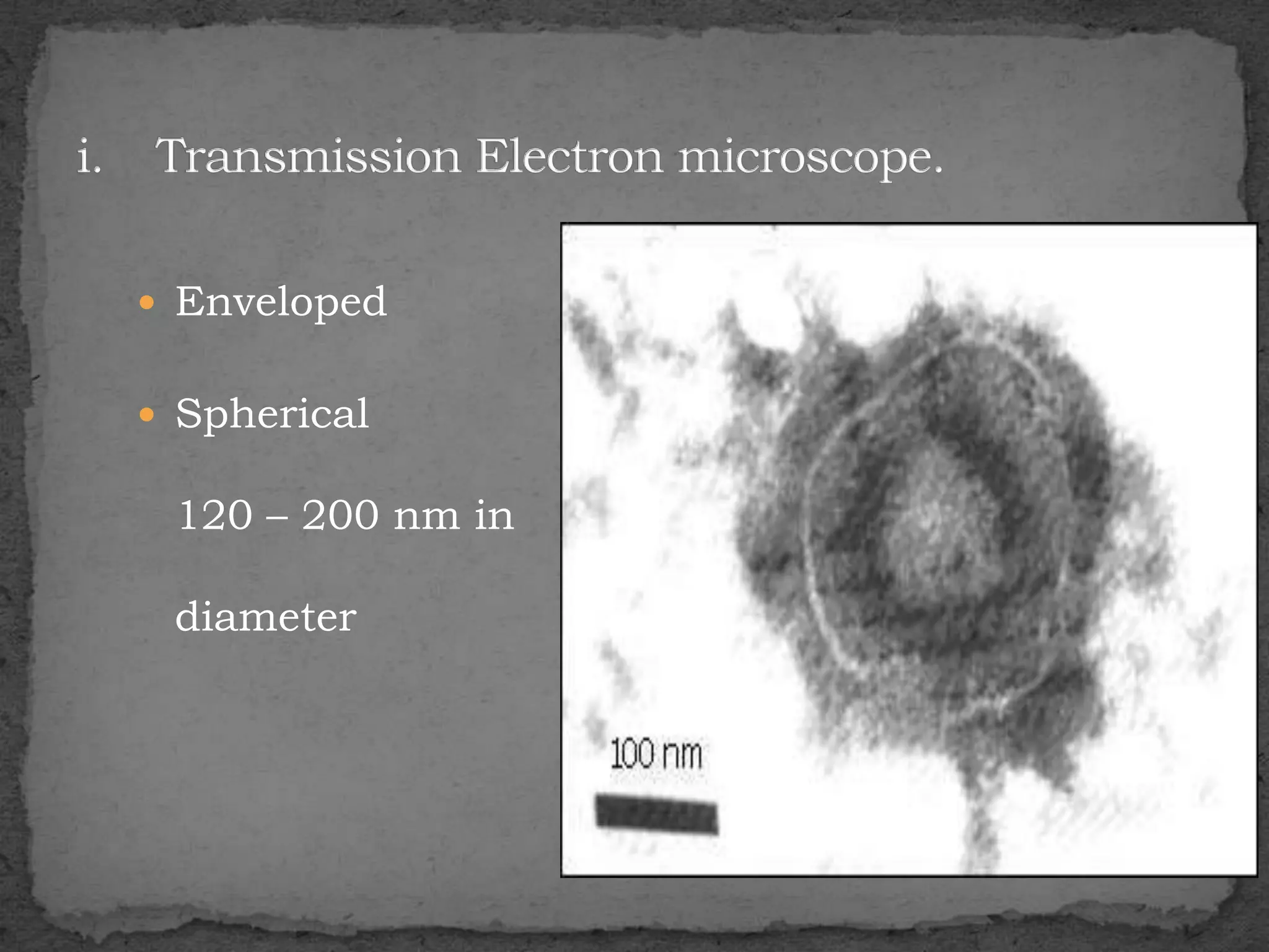 Lab diagnosis of ToRCH complex | PPSX
