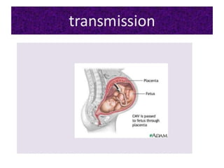 Torch infection | PPT