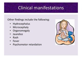 Torch infection | PPT