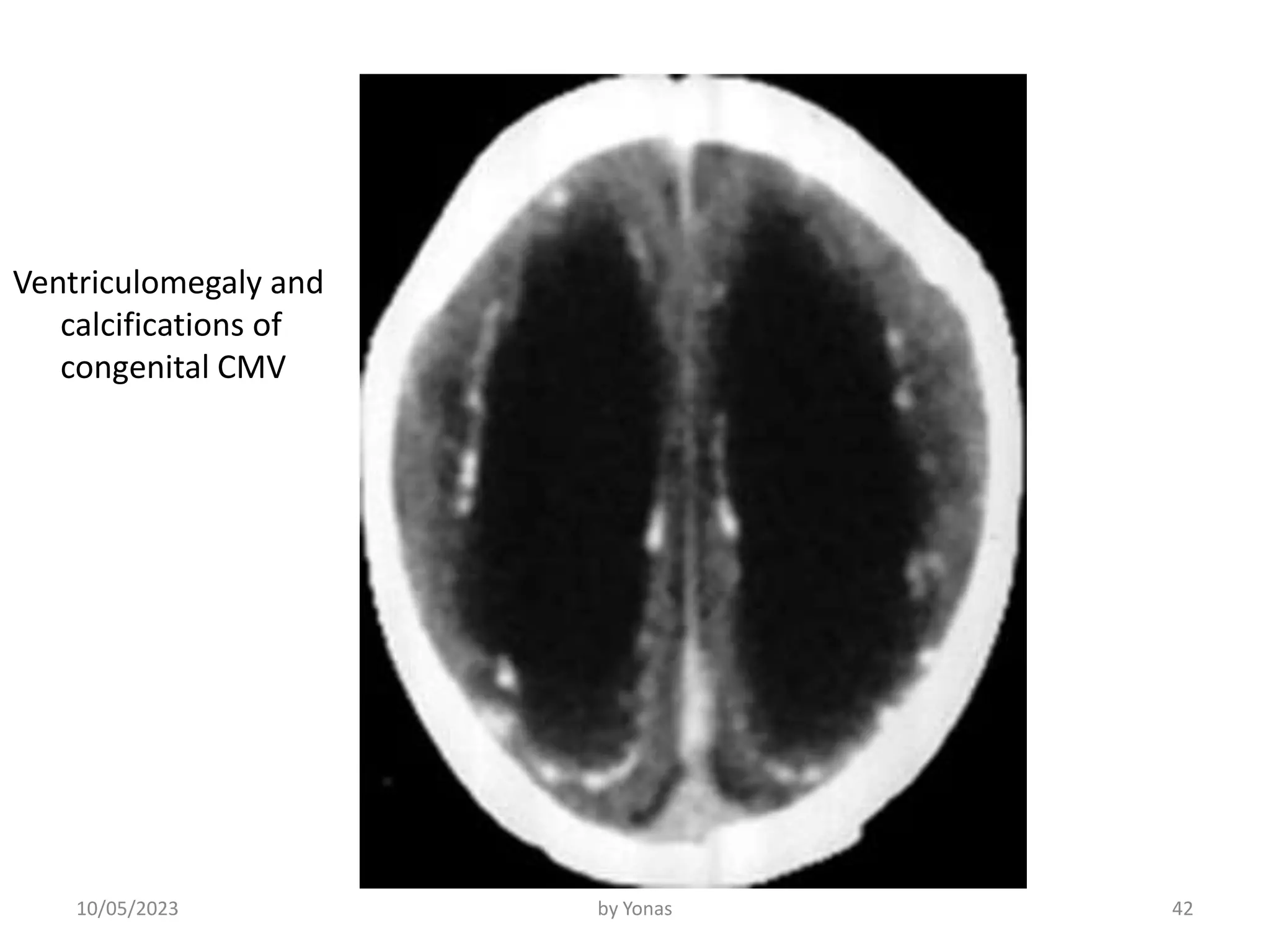TORCH Infections.pptx | Pregnancy | Reproductive Health