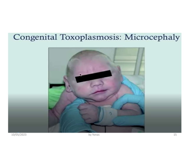 TORCH Infections.pptx | Pregnancy | Reproductive Health