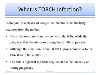 TORCH Infections.pptx