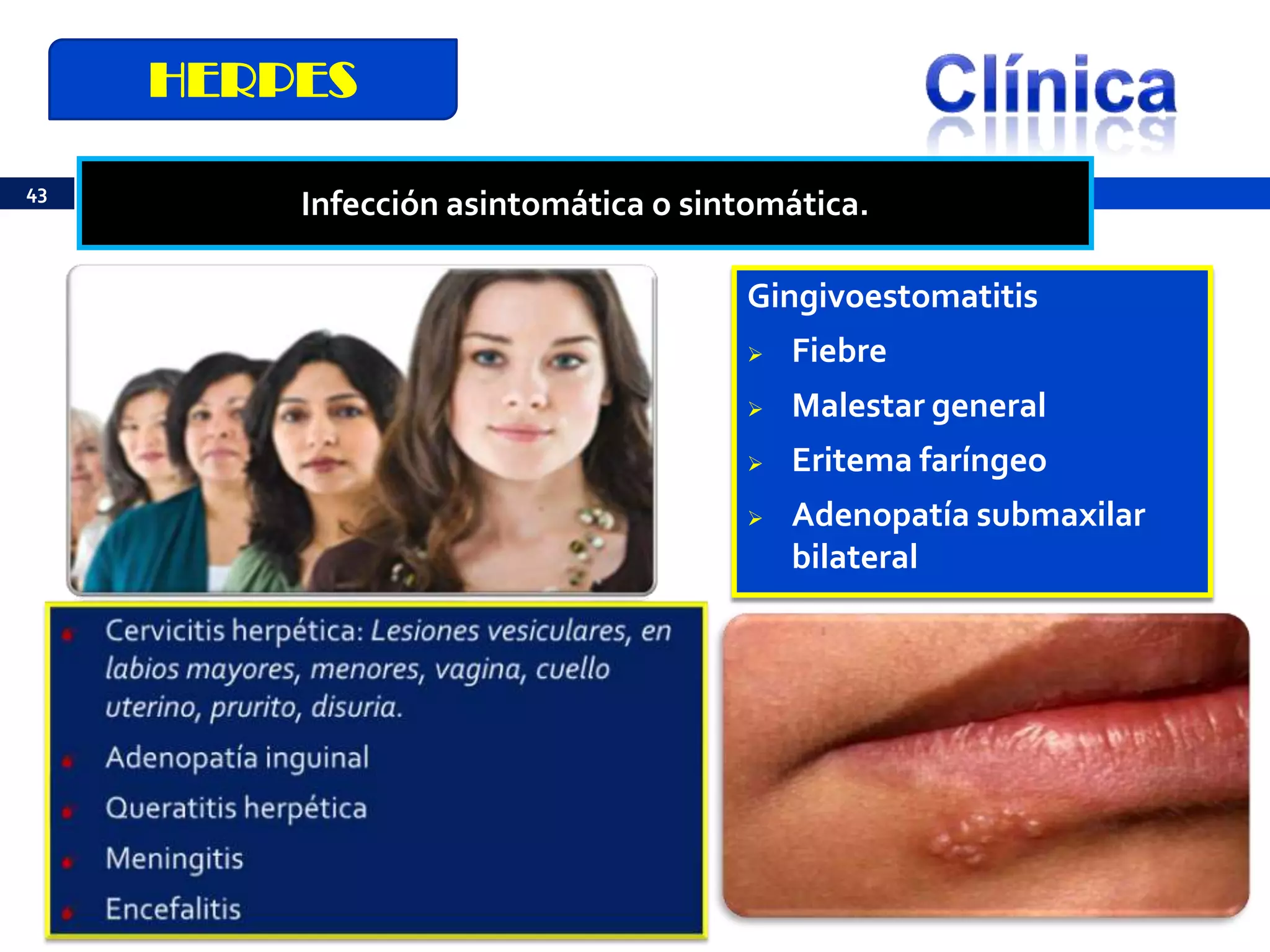 Torch y embarazo | PPTX