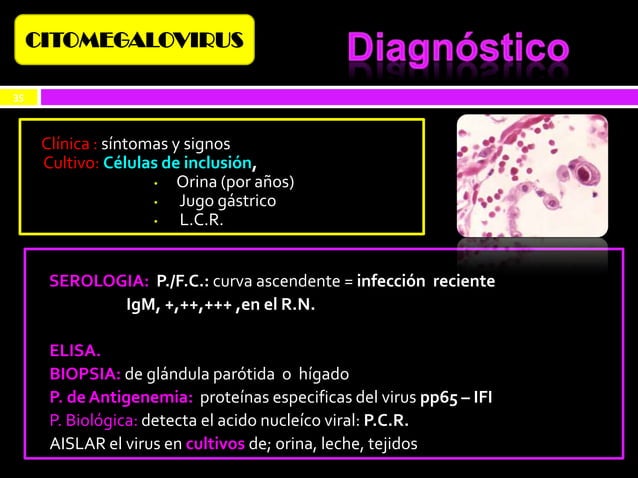 Torch y embarazo | PPTX