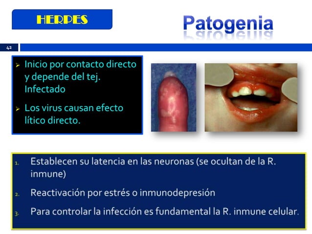 Torch y embarazo | PPTX
