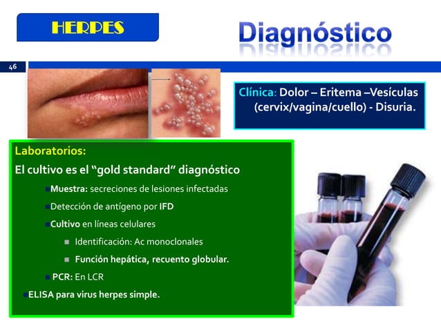 Torch y embarazo | PPTX