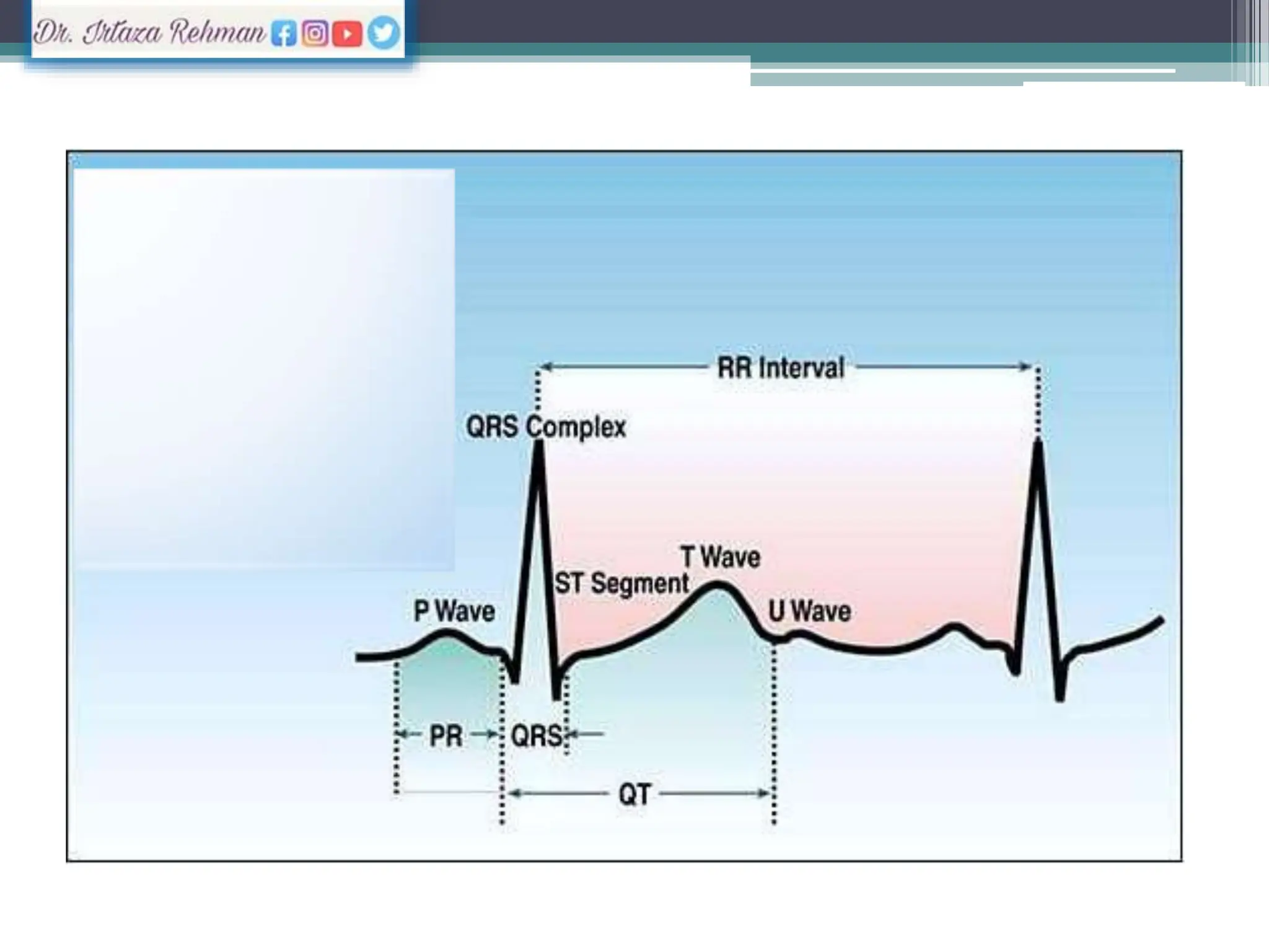 To record Normal Human ECG by Using Bipolar.pptx | Heart and ...
