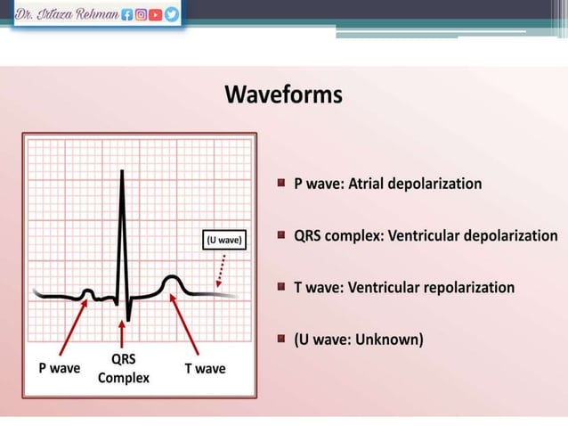 To record Normal Human ECG by Using Bipolar.pptx | Heart and ...