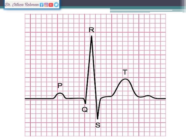 To record Normal Human ECG by Using Bipolar.pptx | Heart and ...