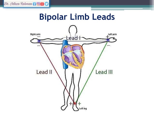 To record Normal Human ECG by Using Bipolar.pptx | Heart and ...