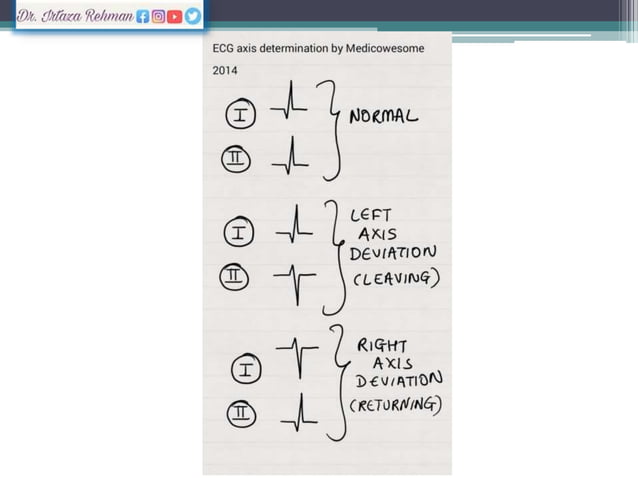To record Normal Human ECG by Using Bipolar.pptx | Heart and ...