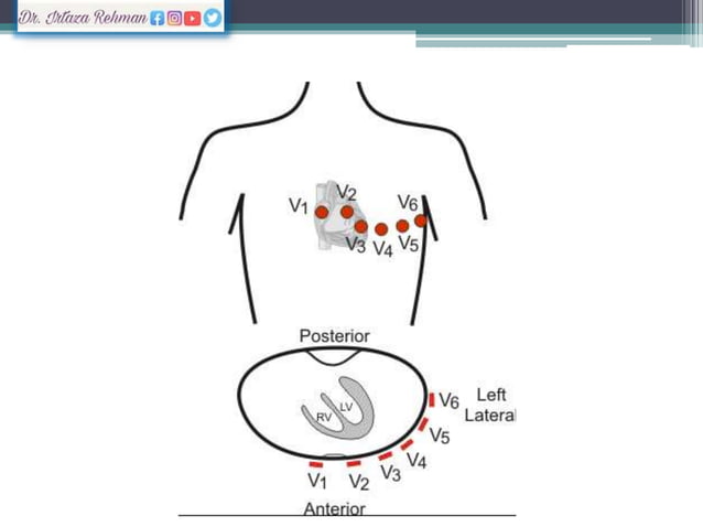 To record Normal Human ECG by Using Bipolar.pptx | Heart and ...