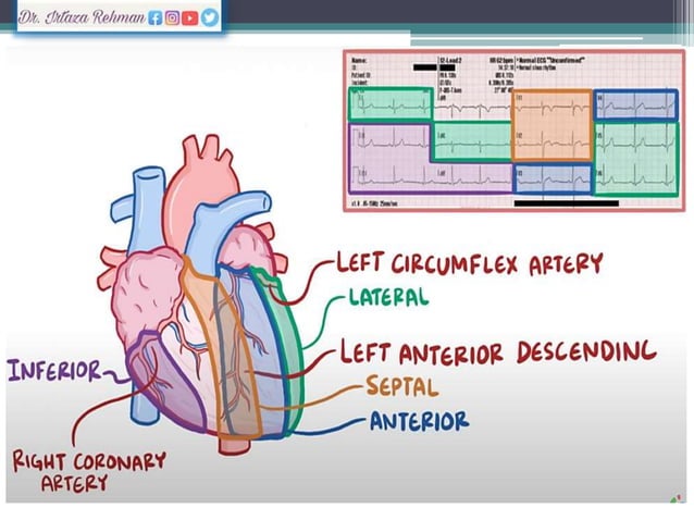 To record Normal Human ECG by Using Bipolar.pptx | Heart and ...