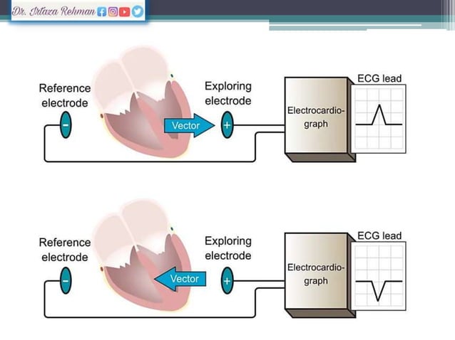 To record Normal Human ECG by Using Bipolar.pptx | Heart and ...