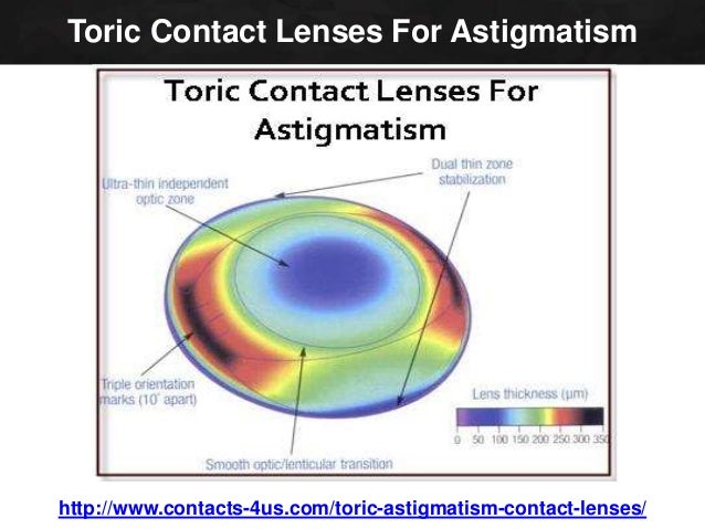 Toric Contact Lenses For Astigmatism Contacts 4us
