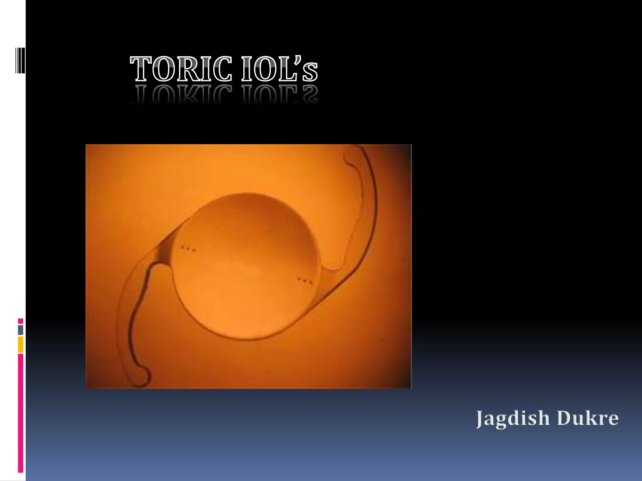 Toric iol | PPTX