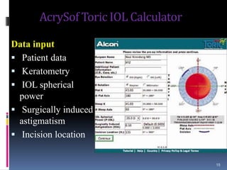 Toric iol | PPTX